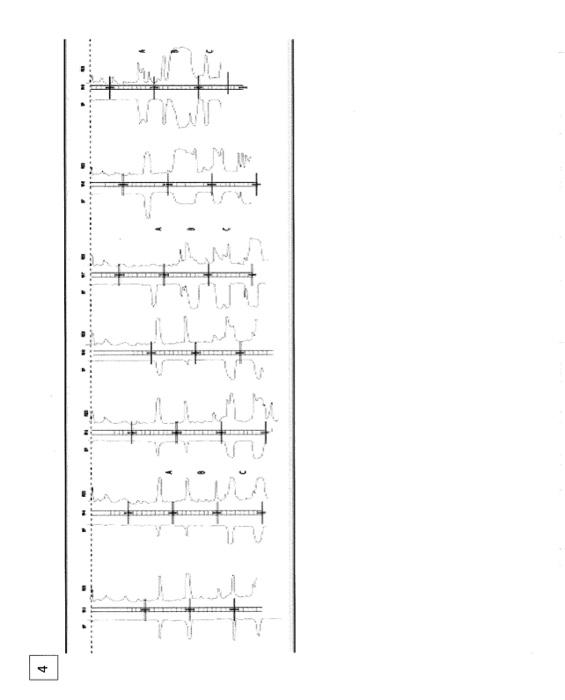 Solved 1 In the examples given, draw correlation lines | Chegg.com