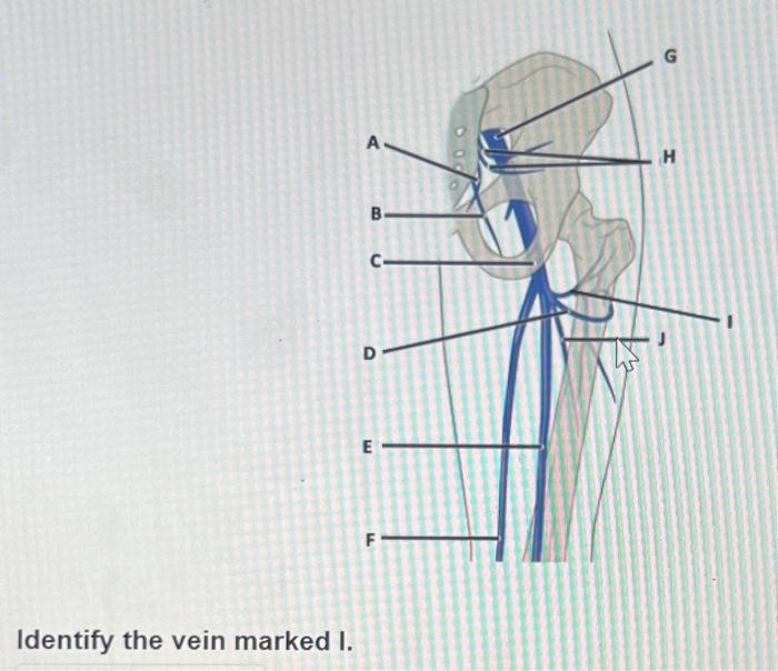 Solved Identify the vein marked I. | Chegg.com