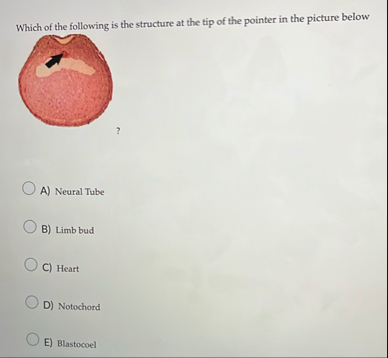 Solved Which of the following is the structure at the tip of | Chegg.com