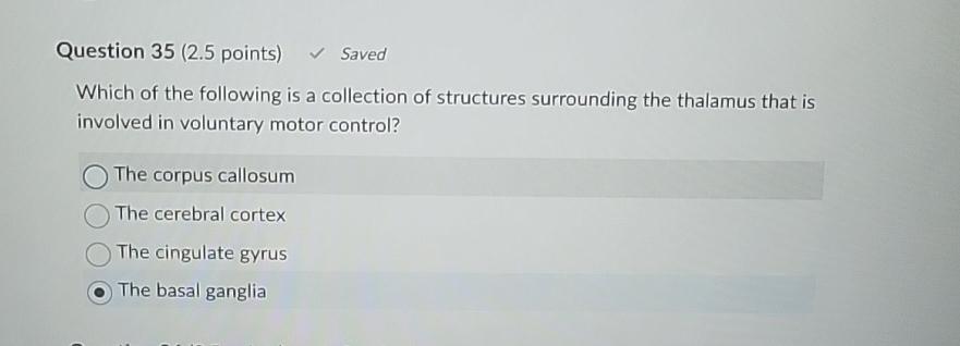 Solved Question 35 (2.5 ﻿points) ﻿SavedWhich of the | Chegg.com