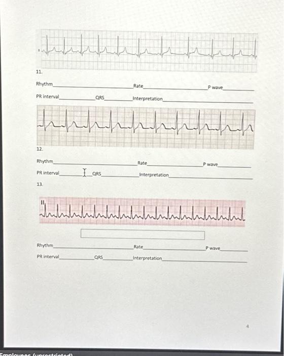 Solved 11. Rhythm Rate P wave PR interval QRS Interpretation | Chegg.com