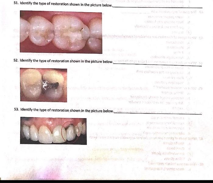 Solved 51. Identify the type of restoration shown in the | Chegg.com