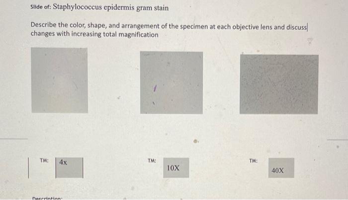 Slide of: E coli Gram stain Describe the color, | Chegg.com