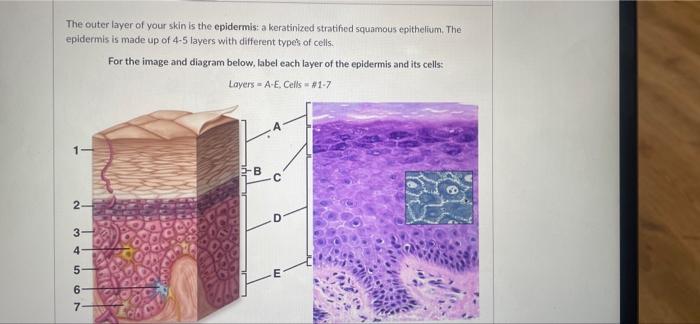Solved The outer layer of your skin is the epidermis: a | Chegg.com