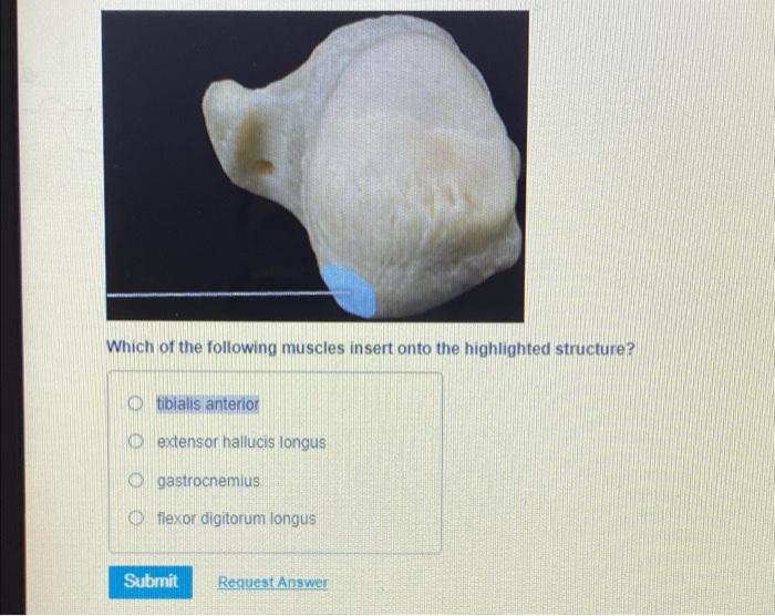 Solved Which of the following muscles insert onto the | Chegg.com