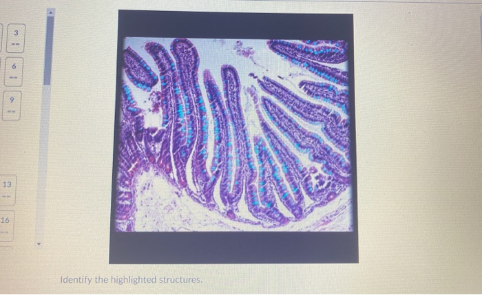 Solved | ය 6 9 13 16 Identify the highlighted structures. | Chegg.com