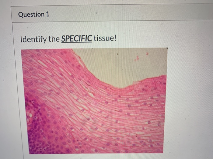 Solved Question 1 Identify the SPECIFIC tissue! | Chegg.com