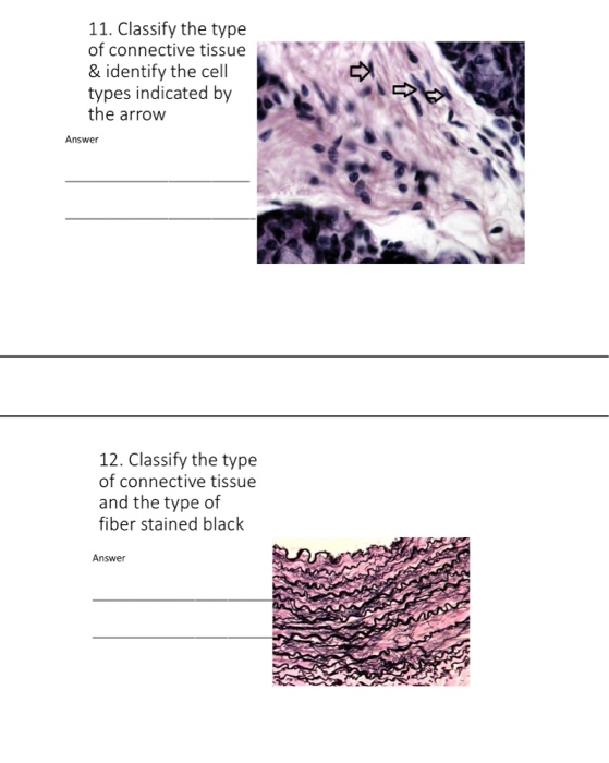 Solved 9. Identify the type of Epithelium & where it is | Chegg.com