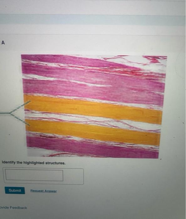 Solved v Part A Identify the highlighted structure. Submit | Chegg.com