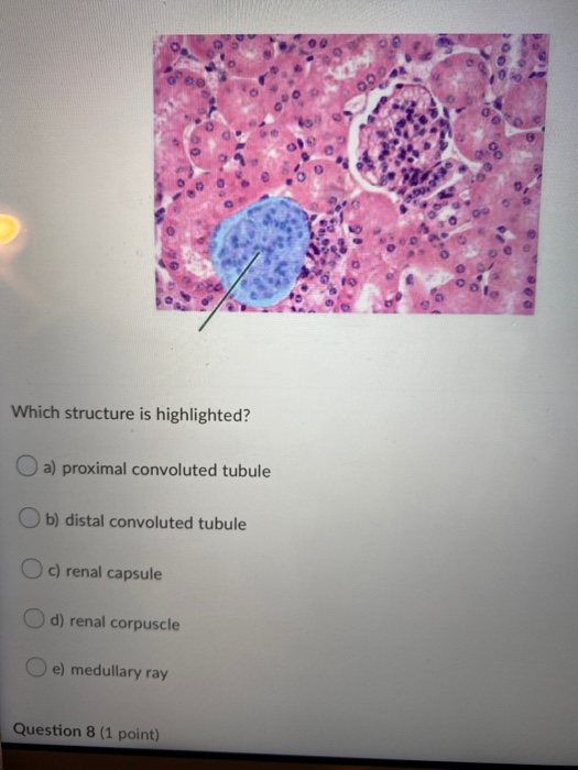 Solved Which structure is highlighted? a) proximal | Chegg.com