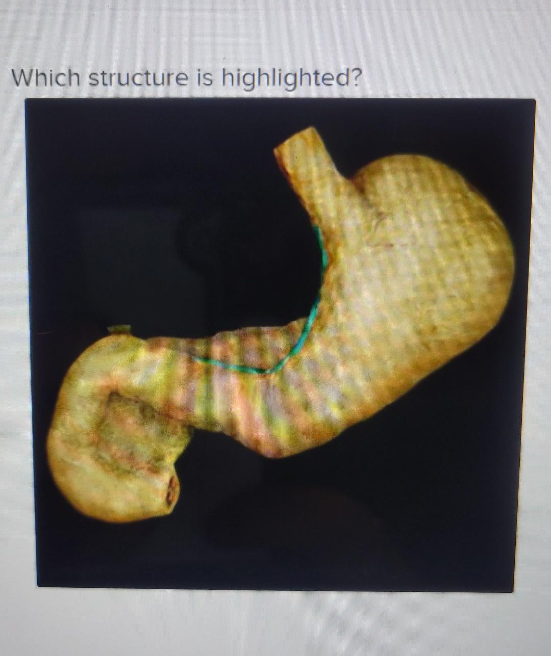 Solved ileum duodenum jejunum cecum | Chegg.com