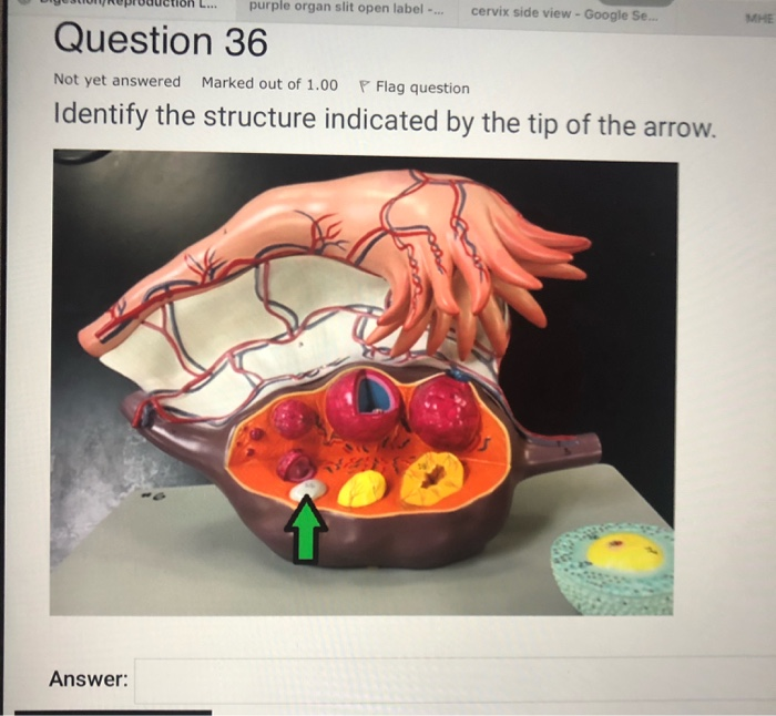 Solved purple organ slit open label -... cervix side view - | Chegg.com