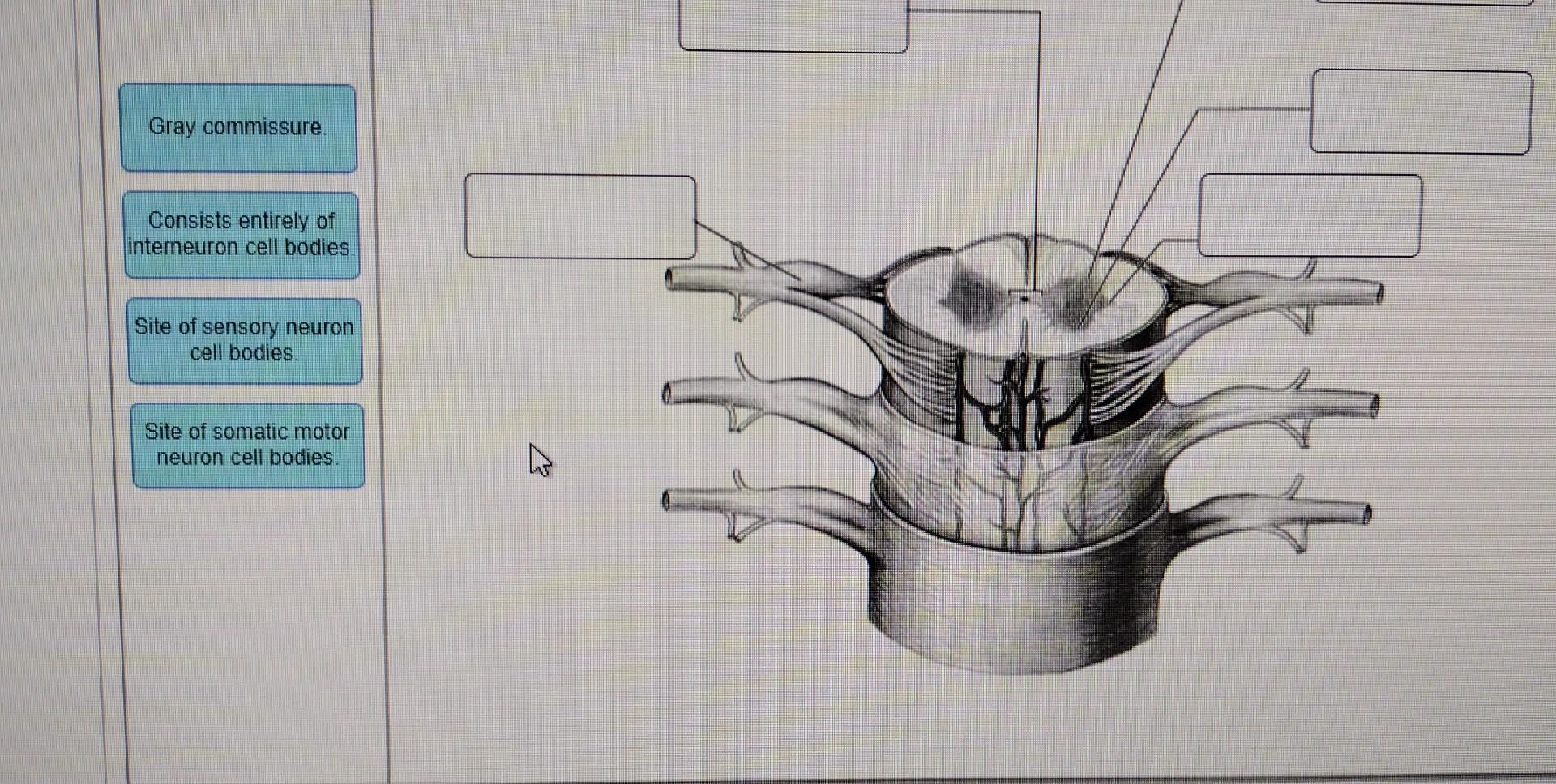 Solved Gray commissure. Consists entirely of interneuron | Chegg.com