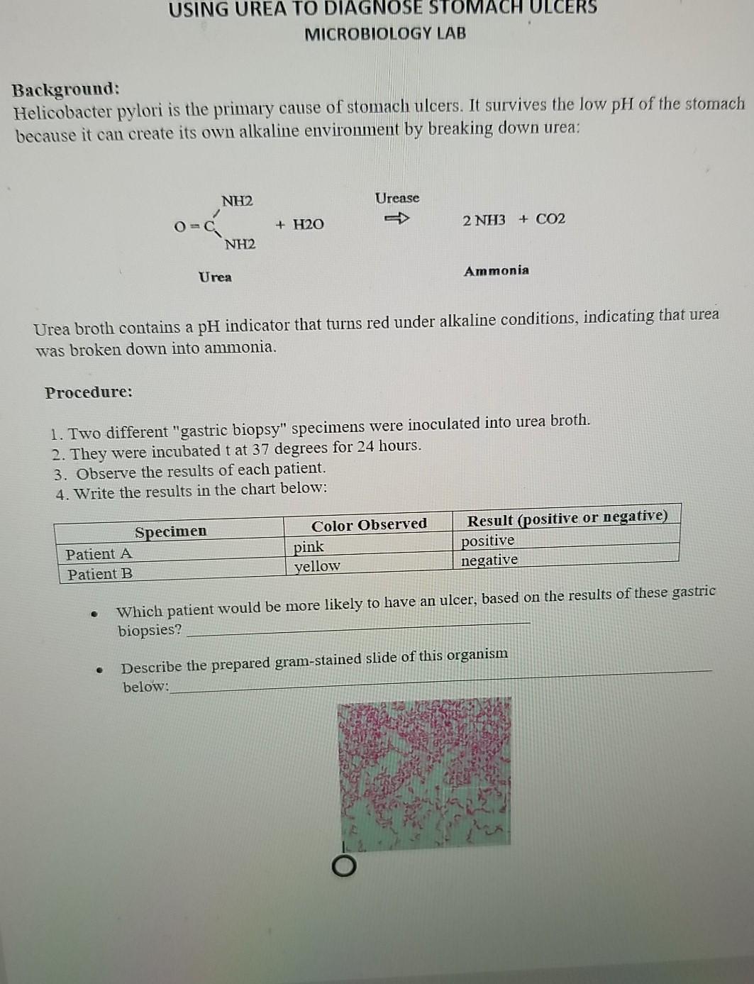 Solved USING UREA TO DIAGNOSE STOMACH ULCERS MICROBIOLOGY | Chegg.com