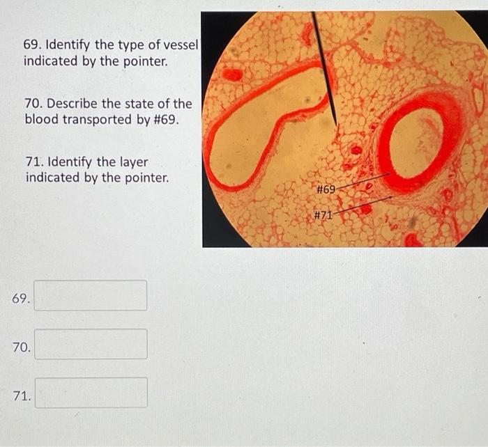 Solved 72. Identify the vessel indicated by the pointer. #72 | Chegg.com