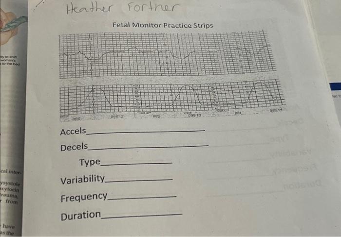 Solved ity to shift woman's s to the bed cal inter- ysystole | Chegg.com
