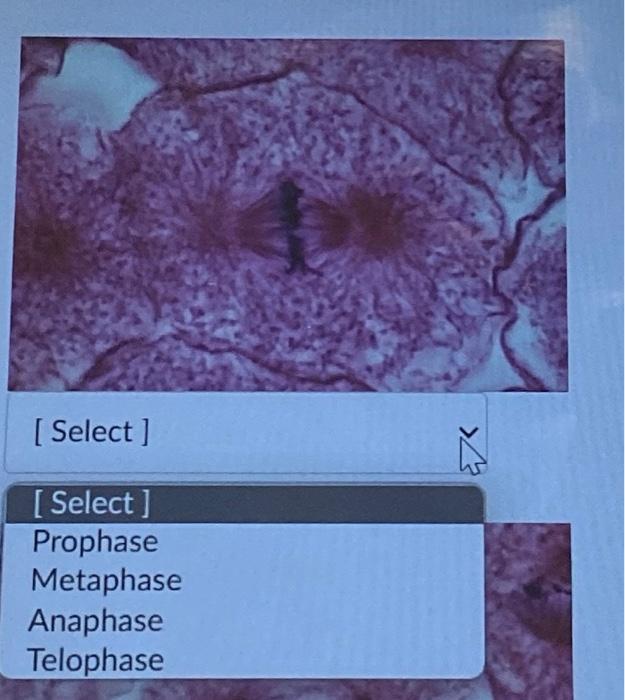 Solved [ Select ] [ Select ] Prophase Metaphase Anaphase | Chegg.com