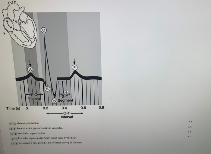 Solved +P-Q Interval S-T O Segment 0.2 0.8 Time (s) 0 0.4 | Chegg.com