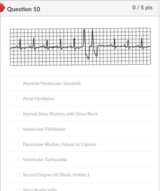 Solved Question 2 0/5 pts Asystole/Ventricular Standstill | Chegg.com
