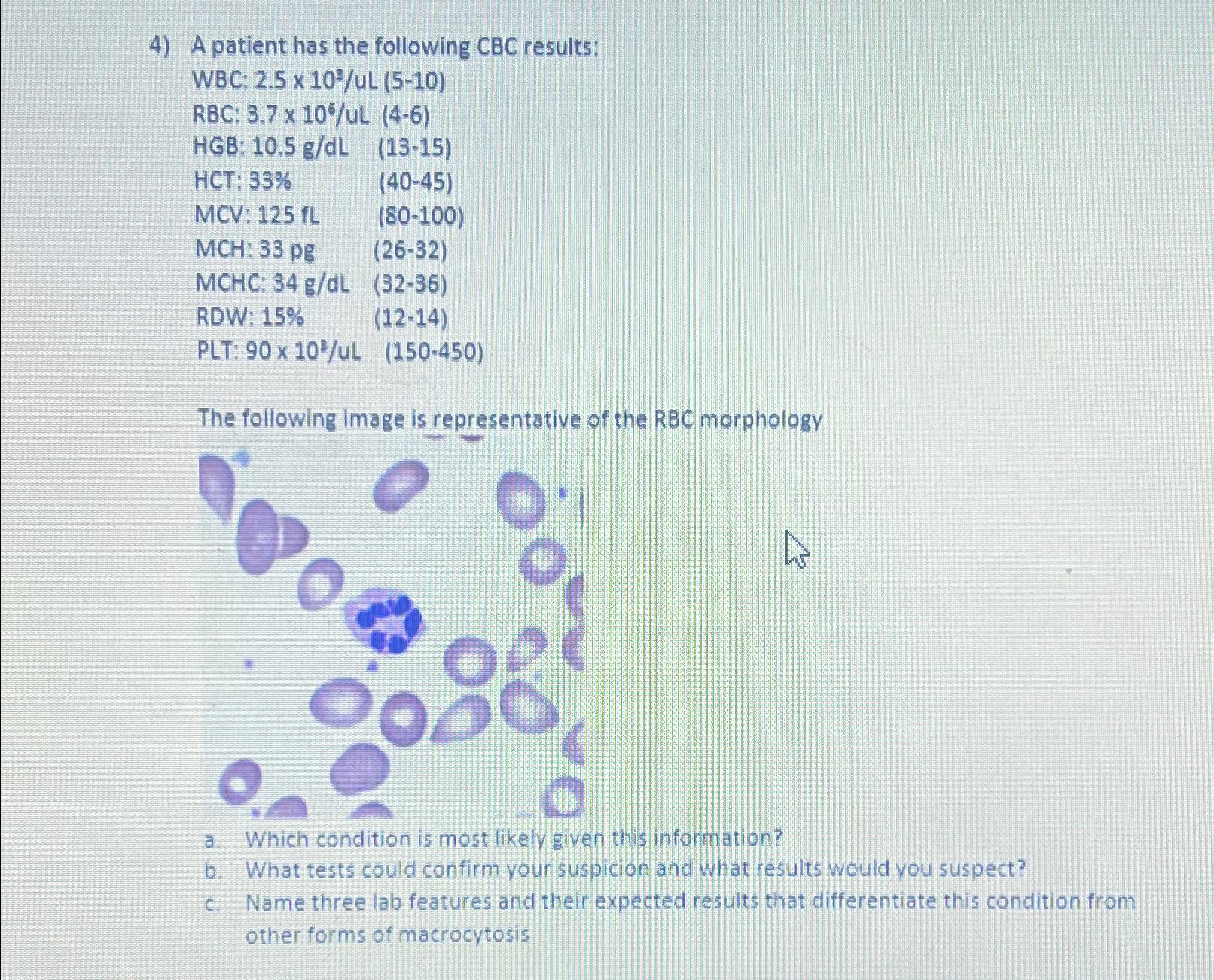 Solved A patient has the following CBC results:\table[[WBC: | Chegg.com