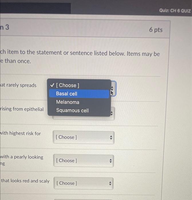 Solved Match each item to the statement or sentence listed | Chegg.com