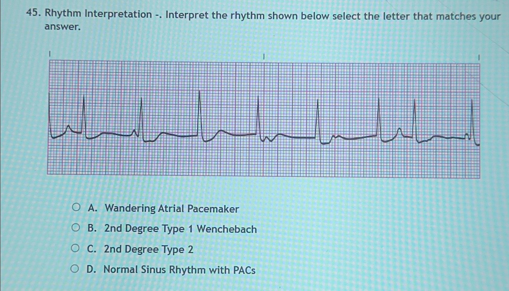 Solved Rhythm Interpretation -. ﻿Interpret the rhythm shown | Chegg.com