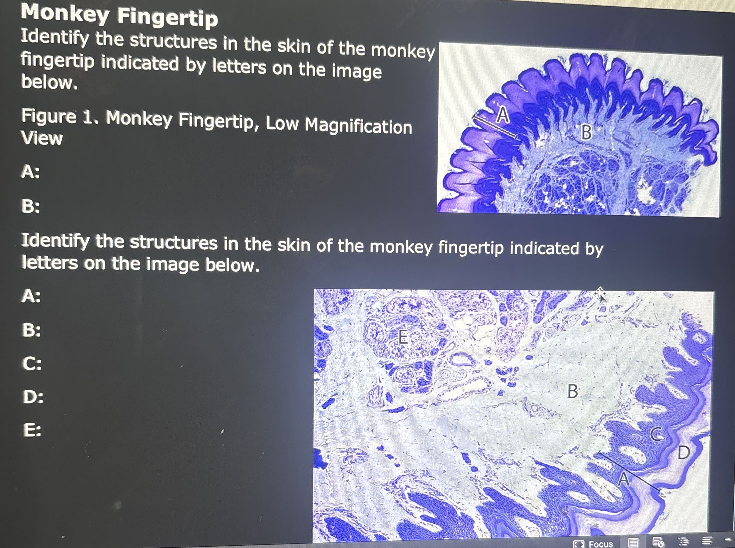 Solved Monkey FingertipIdentify the structures in the skin | Chegg.com
