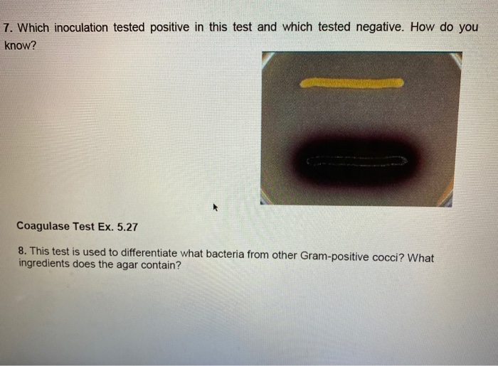 Solved e Q © © 218 ANO 120% I POD Bile Esculin Test Ex. 4.3 | Chegg.com