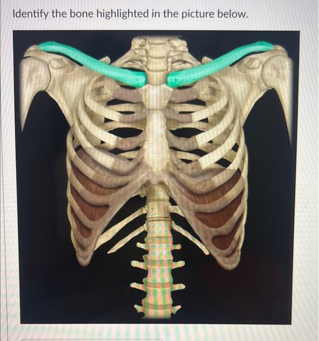 Solved Identify the bone highlighted in the picture below. | Chegg.com