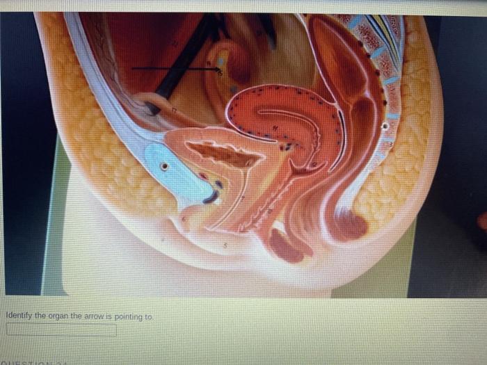 Solved QUESTION 24 Identify the organ the arrow is pointing | Chegg.com