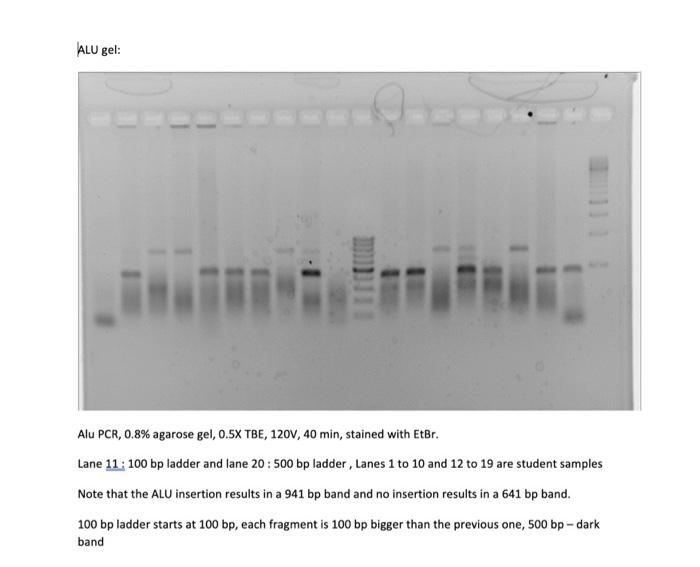 ALU gel: Alu PCR, 0.8% agarose gel, 0.5×TBE,120 V,40 | Chegg.com