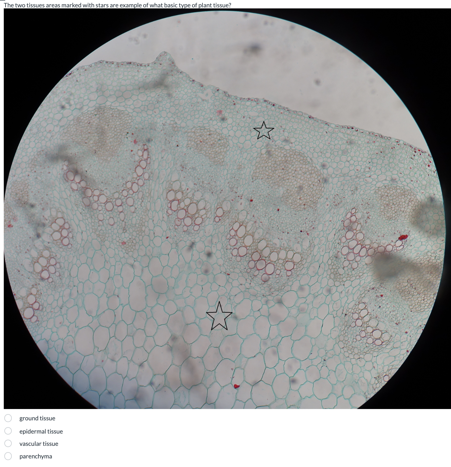Solved The two tissues areas marked with stars are example | Chegg.com