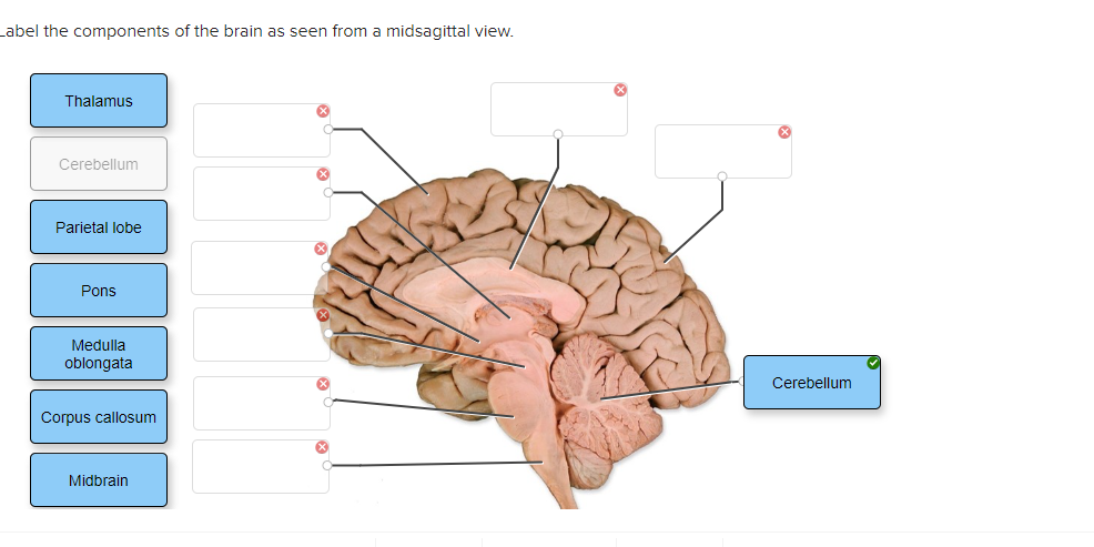 Solved abel the components of the brain as seen from a | Chegg.com