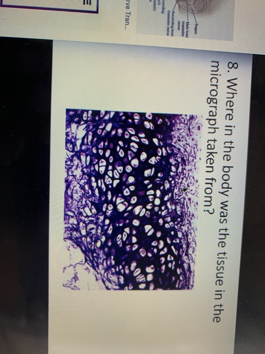 Solved 8. Where in the body was the tissue in the micrograph | Chegg.com