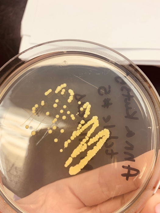 Solved Examine your TSA plate for evidence of microbial | Chegg.com