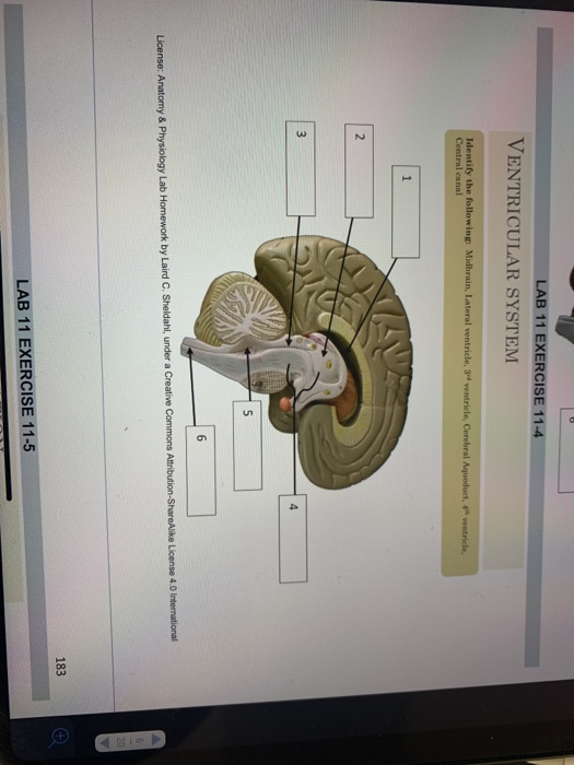 Solved un an LAB 11 EXERCISE 11-4 VENTRICULAR SYSTEM | Chegg.com