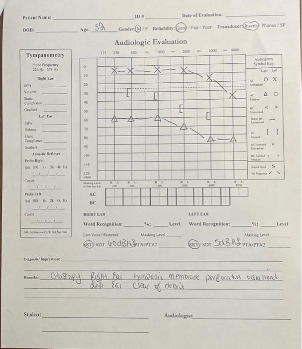 15. For Audiogram #1, using 40 dB SL re: SRT, what | Chegg.com
