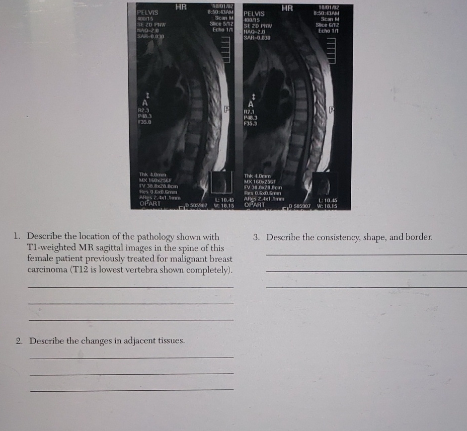 Describe the location of the pathology shown with | Chegg.com