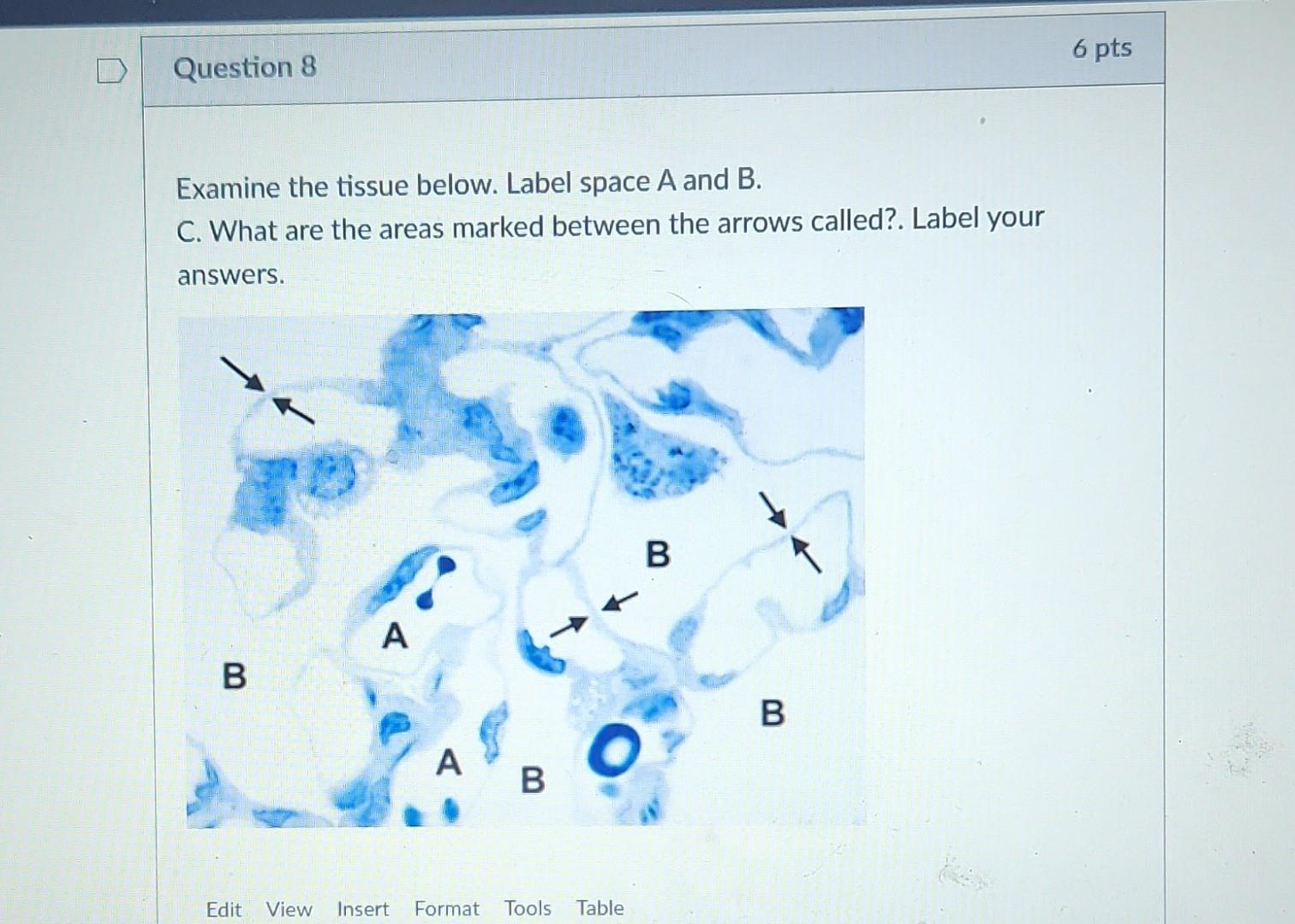 Solved Examine the tissue below. Label space A and B. C. | Chegg.com