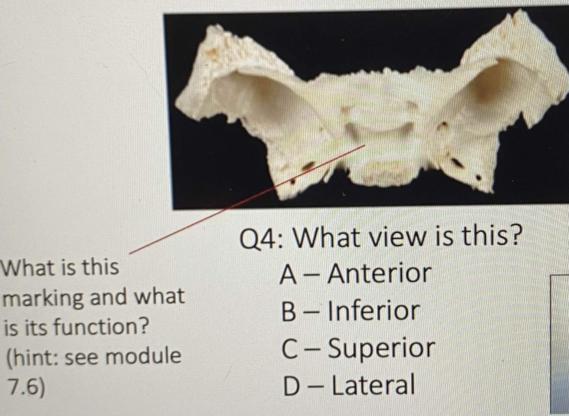 Solved Q4: What view is this?A - ﻿AnteriorB - | Chegg.com