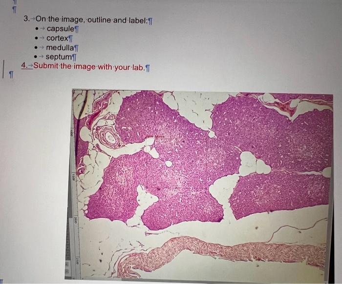 Solved on the image outline the following use the image and | Chegg.com