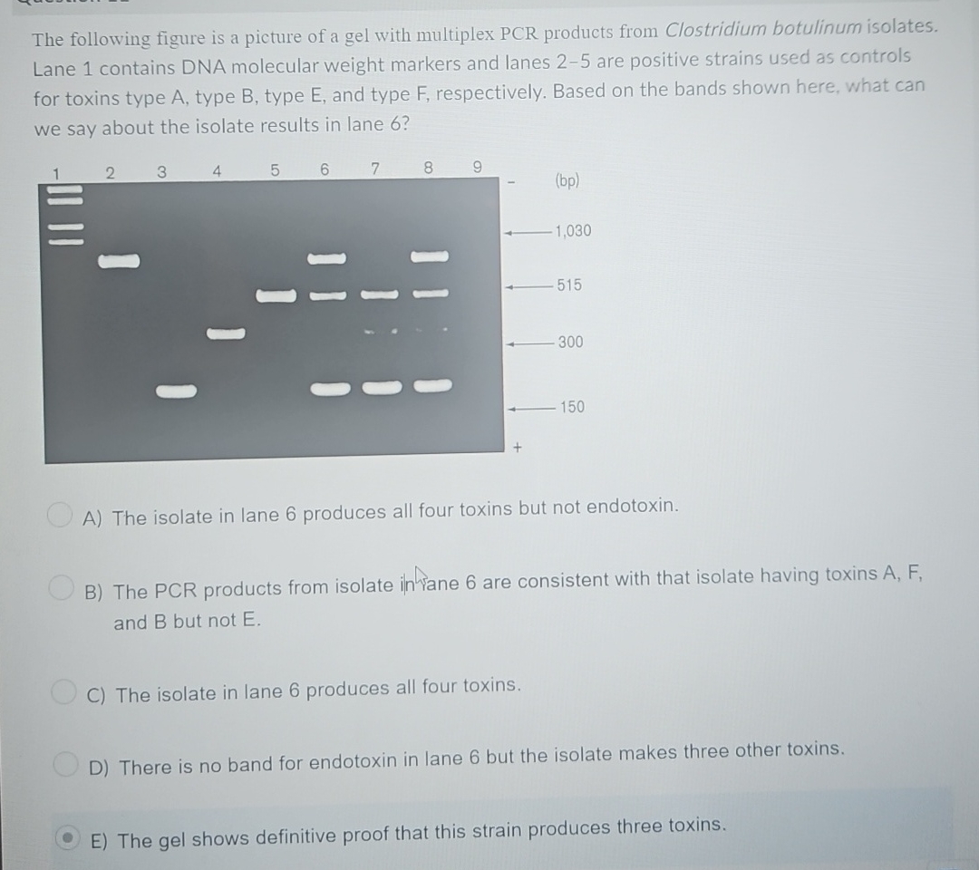 Solved The following figure is a picture of a gel with | Chegg.com
