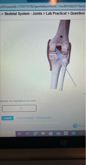 Solved dentify the highilighted structure. | Chegg.com Solved dentify the highilighted structure. | Chegg.com