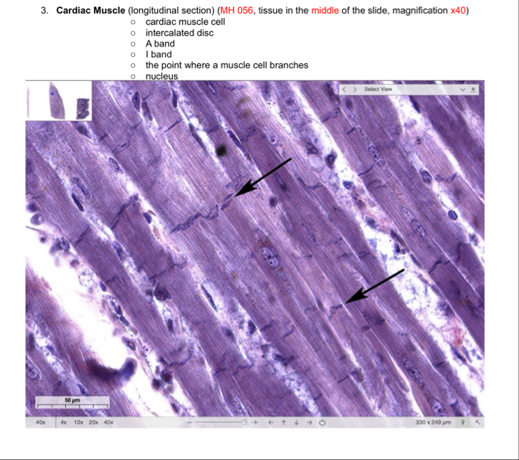 Skeletal Muscle (cross-section) (MH 055a, ﻿tissue on | Chegg.com