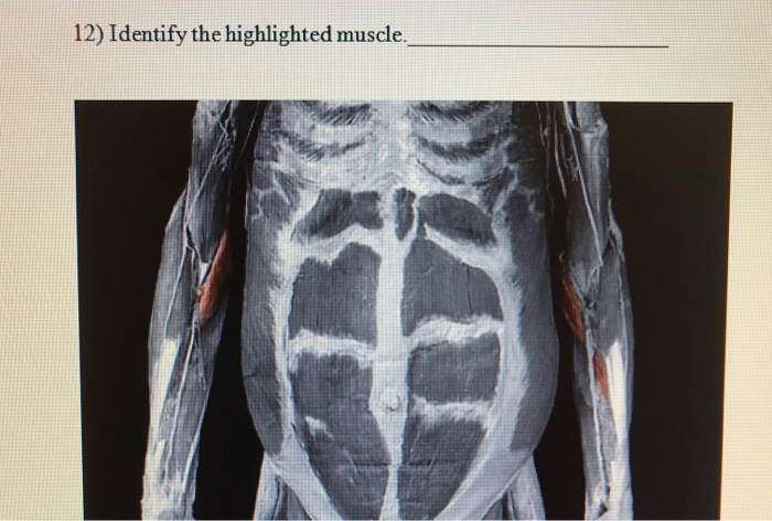 Solved 12) Identify the highlighted muscle. 13) Identify | Chegg.com