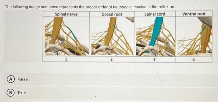 Solved The following image sequence represents the proper | Chegg.com
