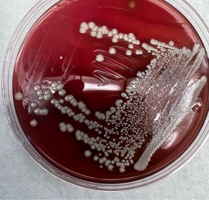 Solved identify the specimen in the blood agar down | Chegg.com