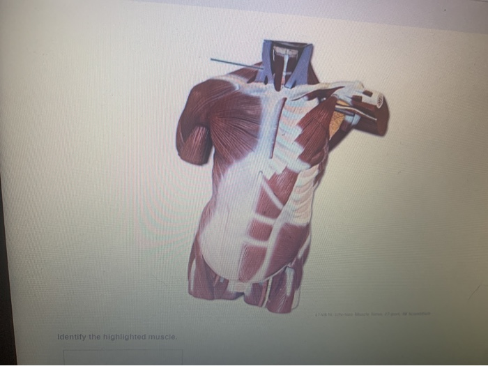 Solved Identify the highlighted muscle. The highlighted | Chegg.com