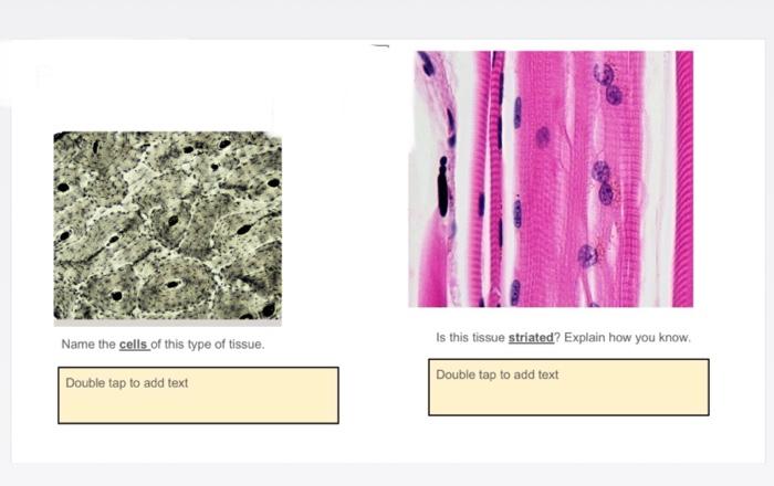 Solved 1. identify the two tissue --2. name the cells of | Chegg.com