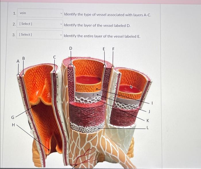 Solved 1. Identify the type of vessel associated with layers | Chegg.com
